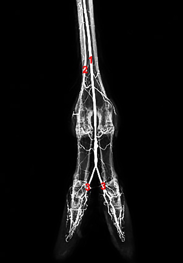 Fig. 1. Dorsal radiographic view of left hind limb in a goat (1: V ...
